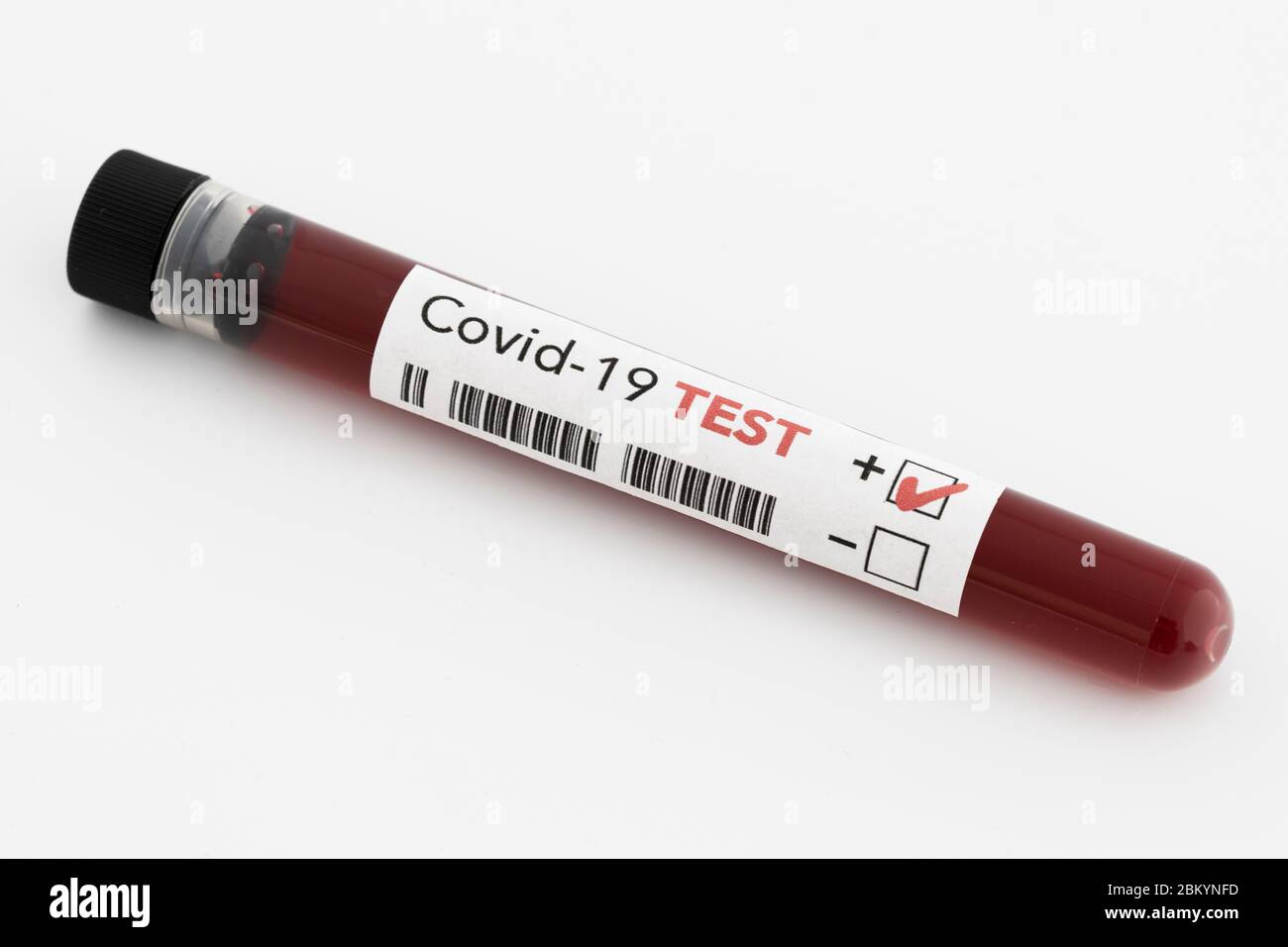 Positive blood test hi-res stock photography and images - Alamy