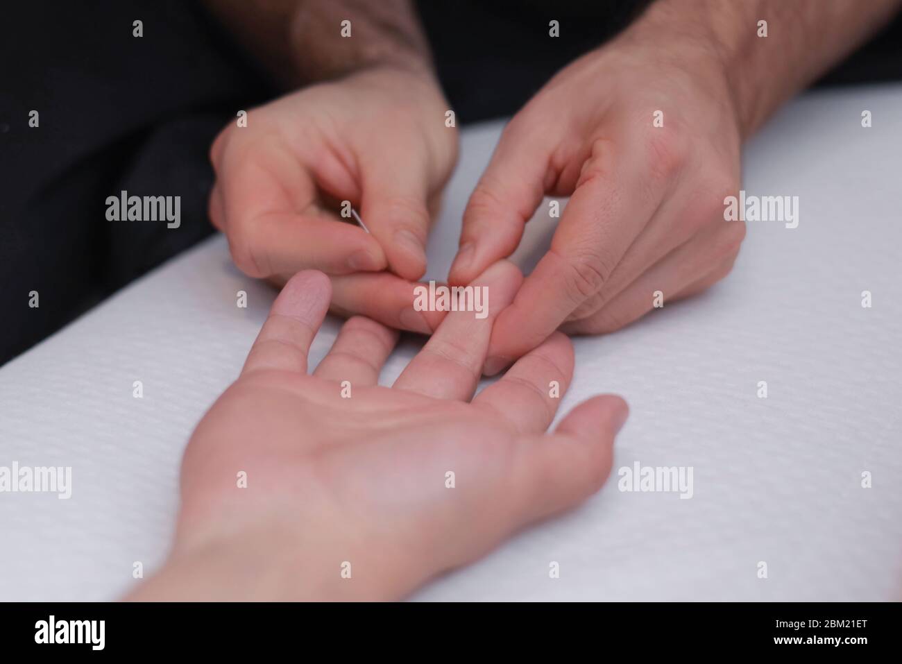 Hand acupuncture hi-res stock photography and images - Alamy