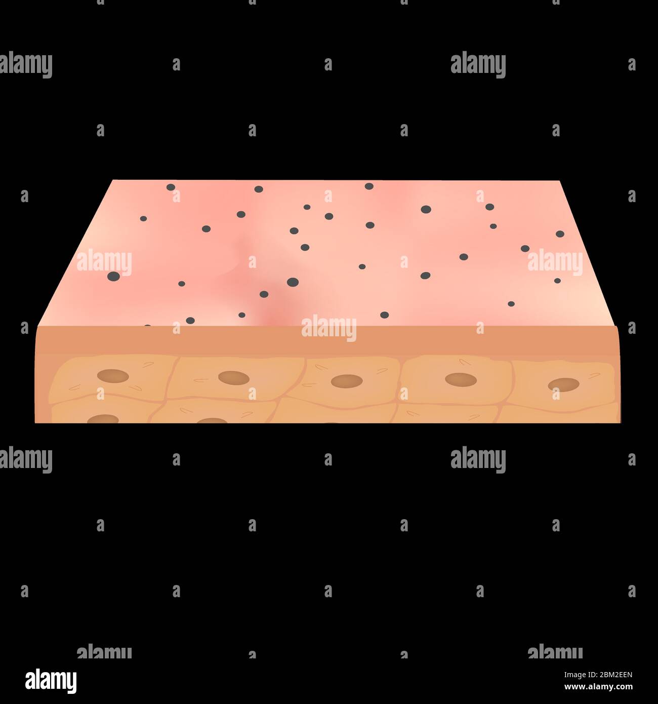 Dermatology diseases Stock Vector Images - Alamy
