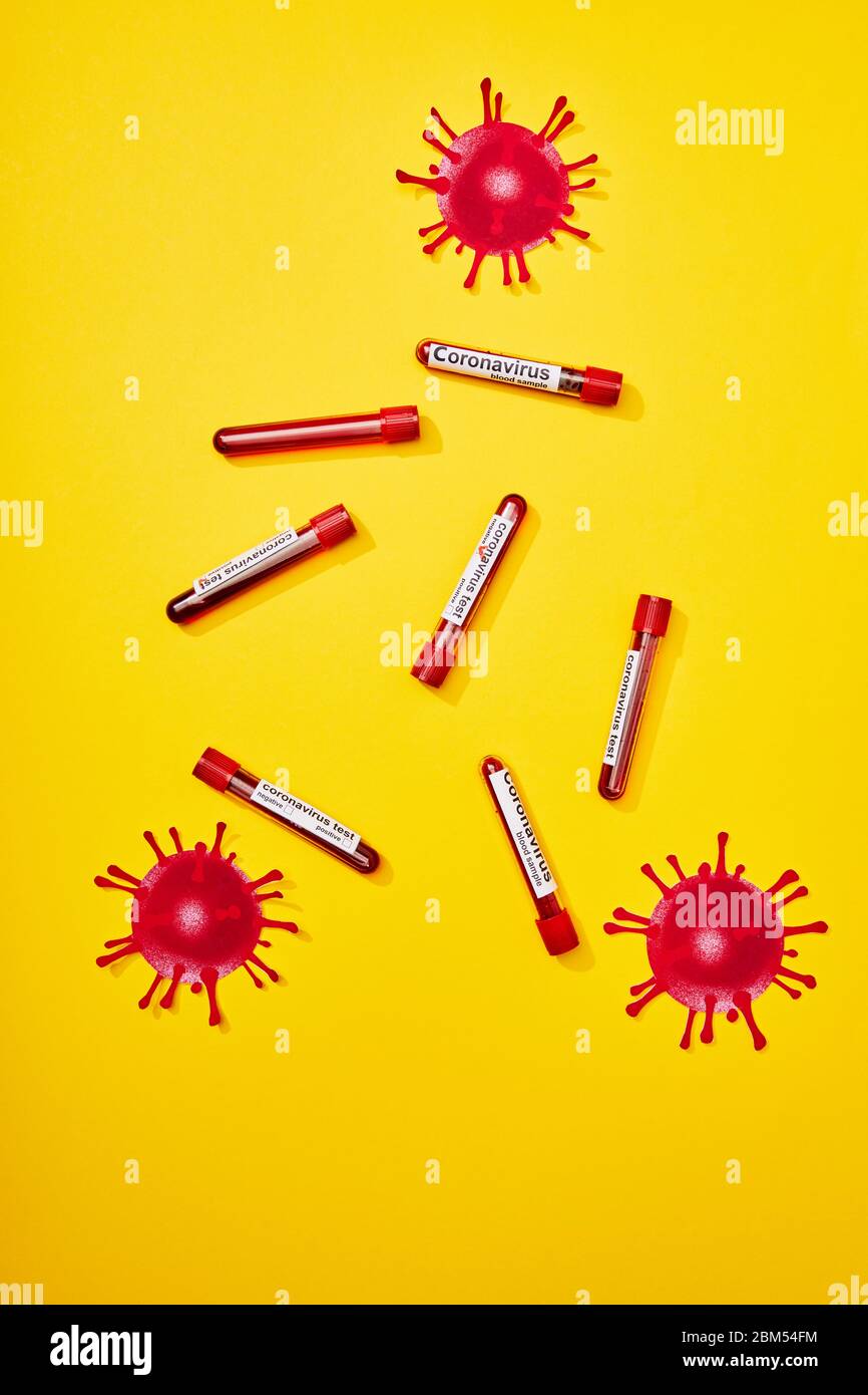 Yellow top blood tubes hi-res stock photography and images - Alamy