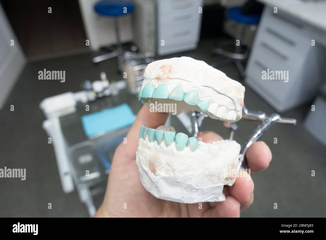 modeling of artificial teeth on a plaster model for visual display ...