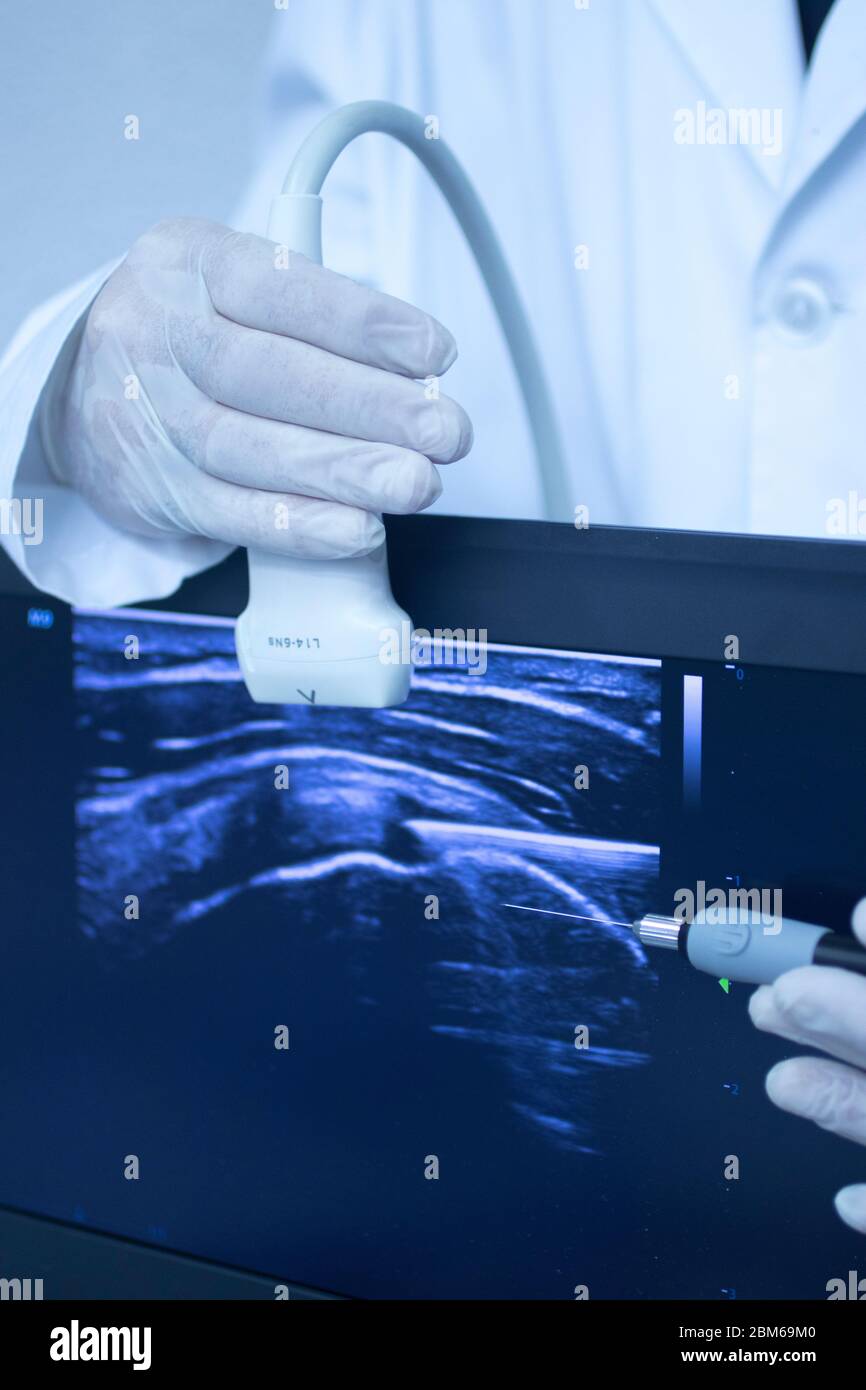 Epi percutaneous intratissue electrolysis scan hi-res stock photography and images - Alamy