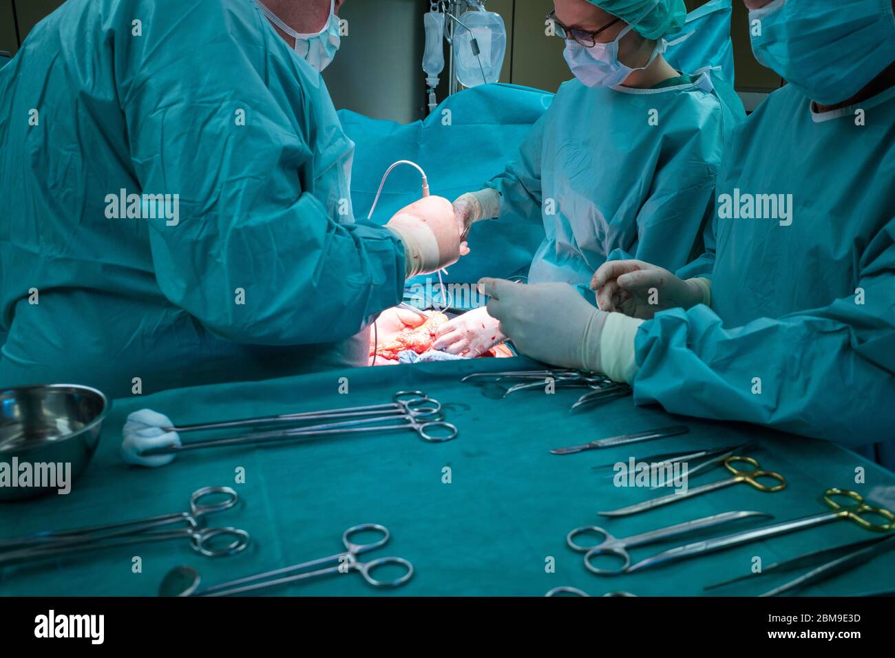 a surgical team performs a surgical abdominal operation Stock Photo - Alamy
