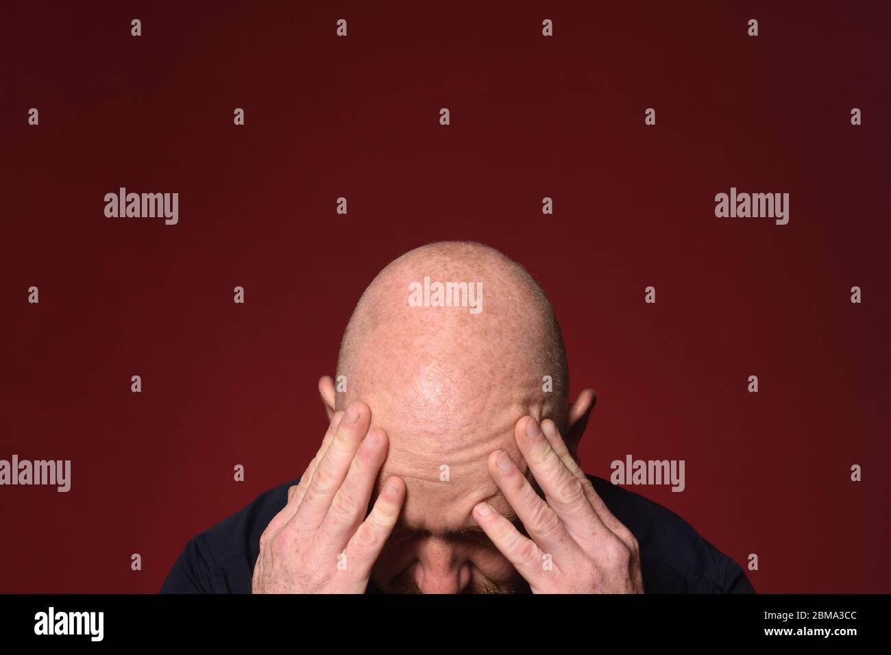 Bald man touch head hi-res stock photography and images - Alamy