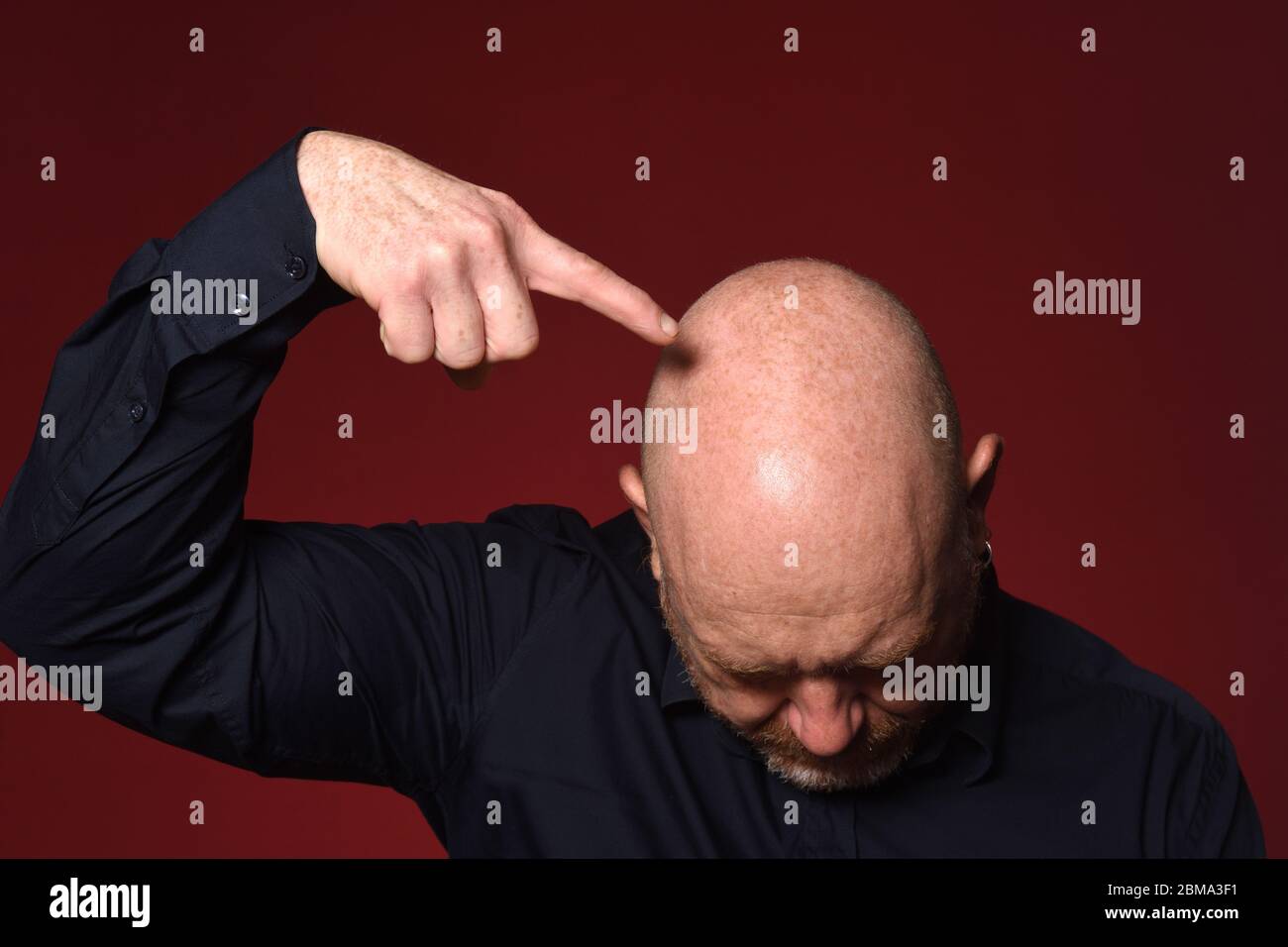 Bald man touch head hi-res stock photography and images - Alamy