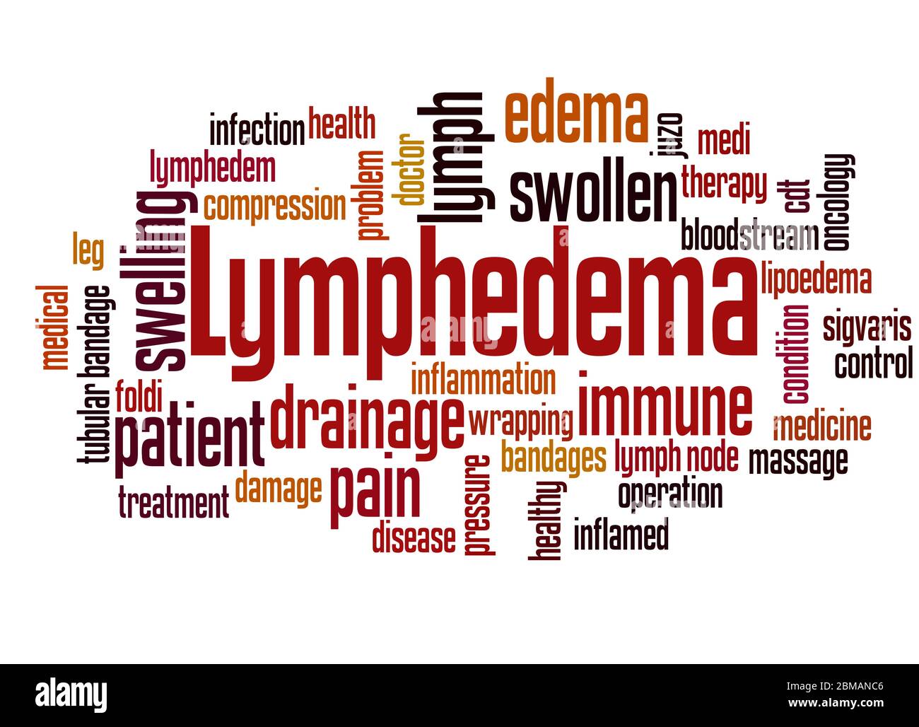 Lymphedema hi-res stock photography and images - Alamy