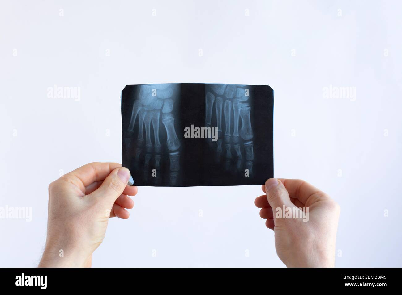 Hands of a doctor are holding Film x-ray both foot. Foot fingers ...