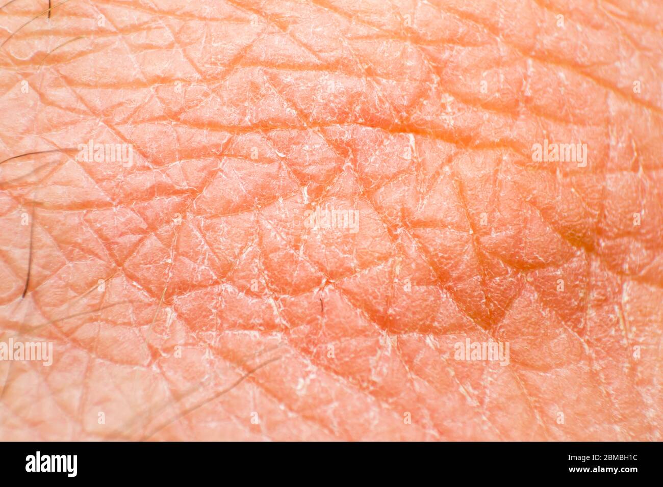 macro photo of dry human skin after frequent washing hands with soap ...