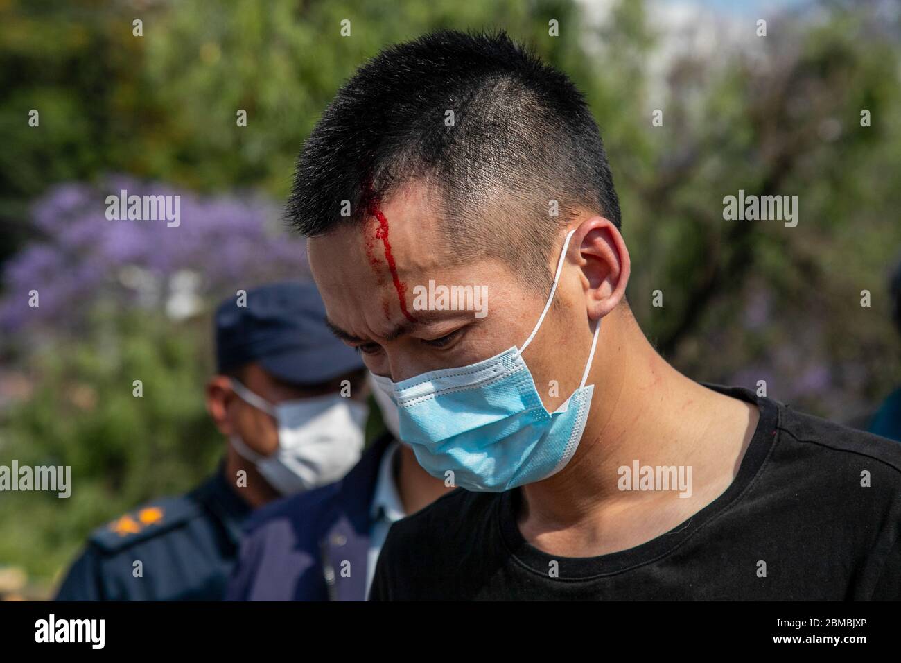 Bleeding wound head hi-res stock photography and images - Alamy