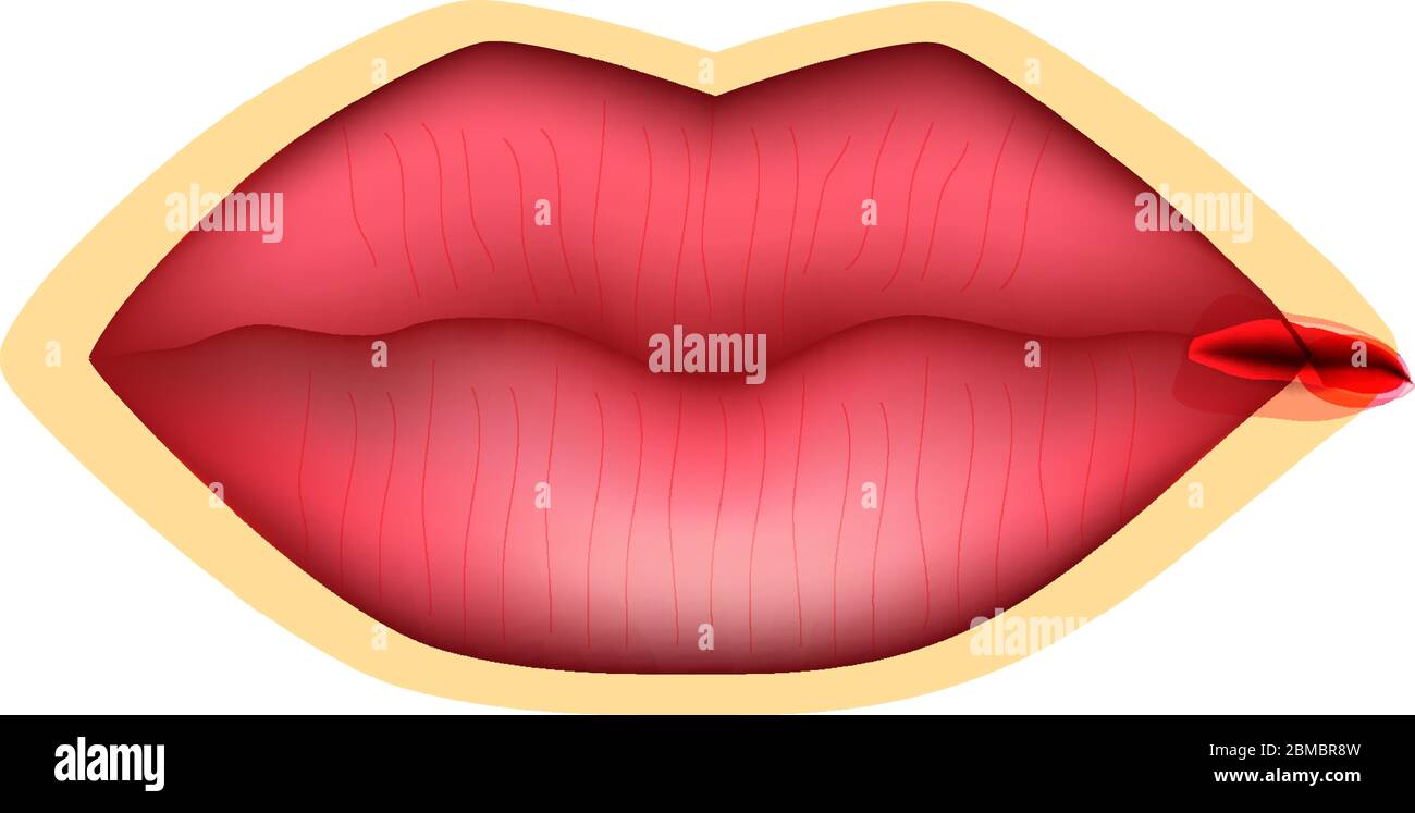 Cracks at the corners of the lips. Dry chapped lips. Wounds in the ...