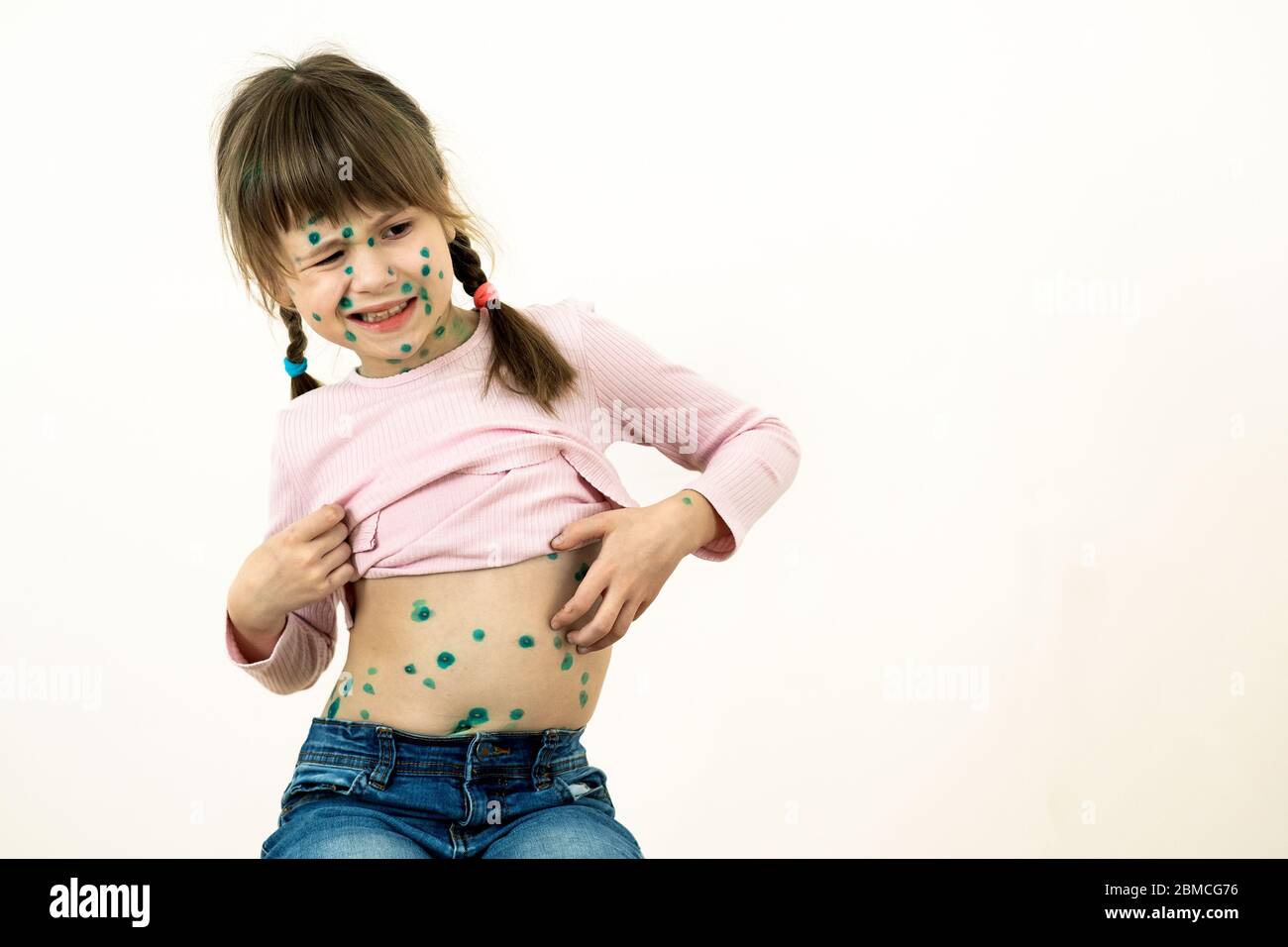 Child girl covered with green rashes on face and stomach ill with ...