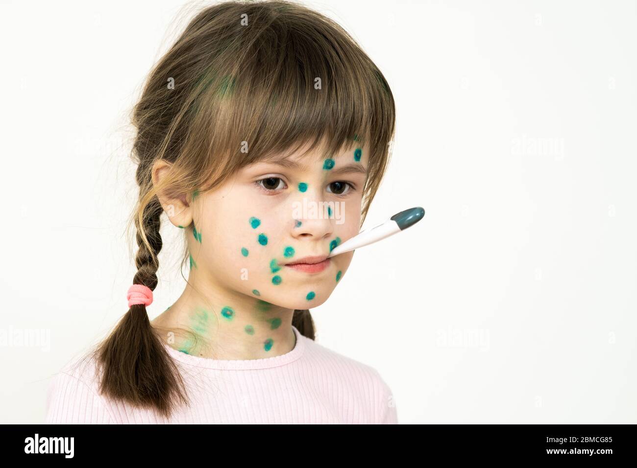 Rashes In Child High Resolution Stock Photography and Images - Alamy