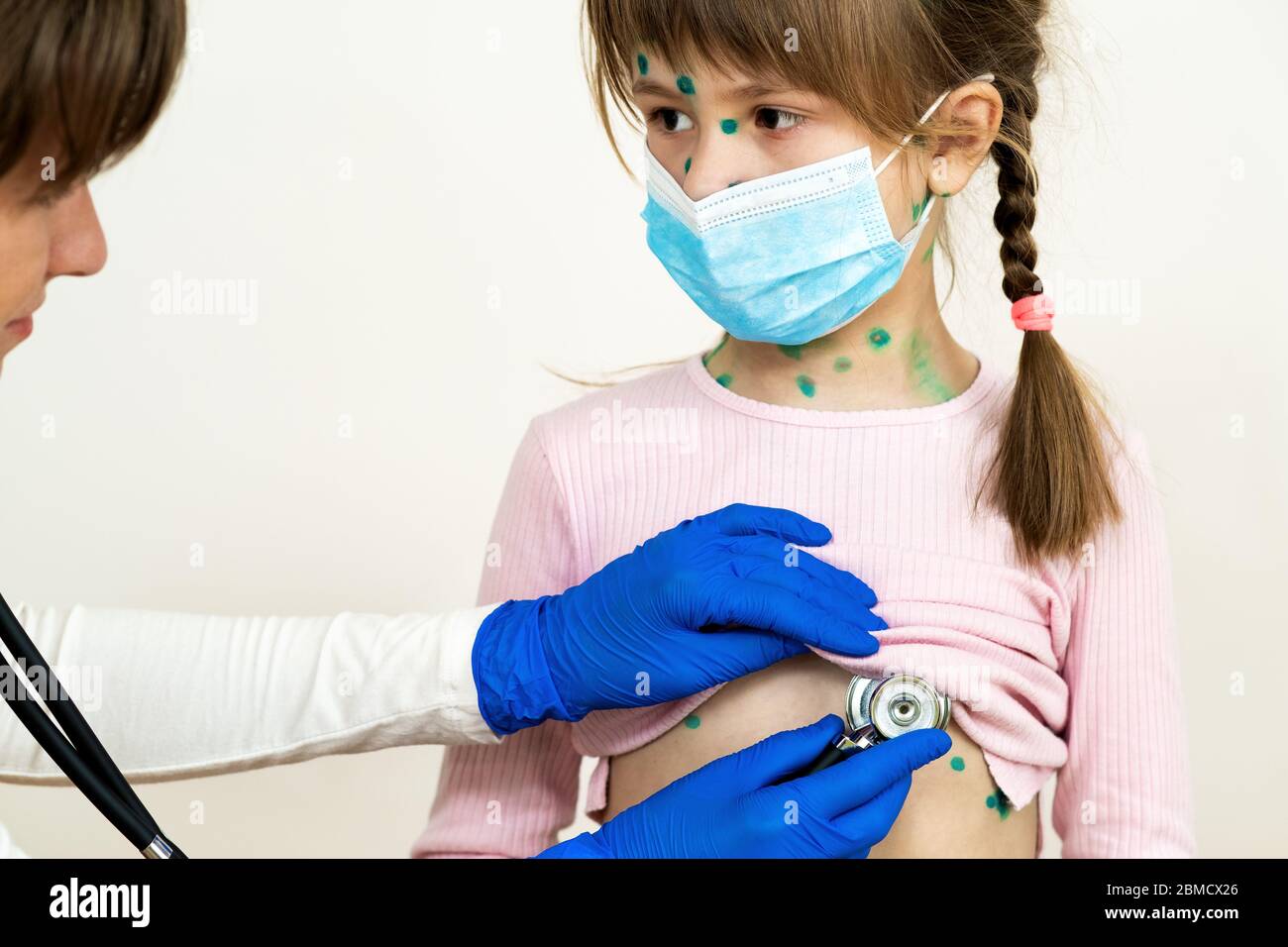 Doctor examining child girl covered with green rashes on face and ...