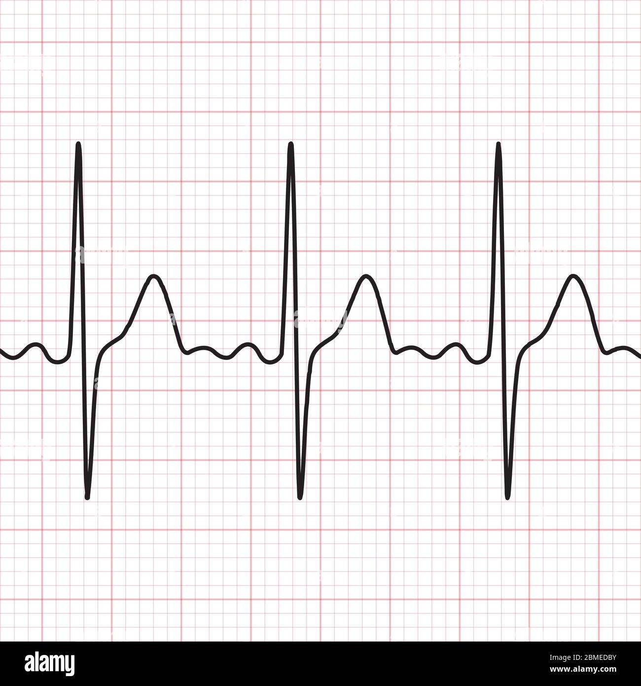 Cardiogram. Electrocardiogram. Graphic representation of heart work ...