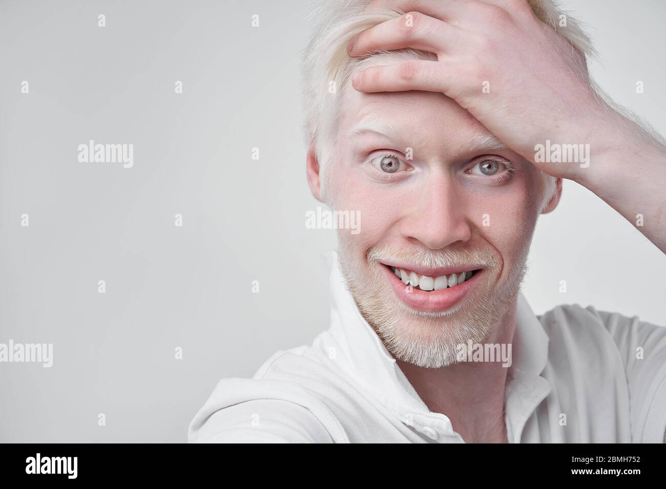 Albino man hi-res stock photography and images - Alamy