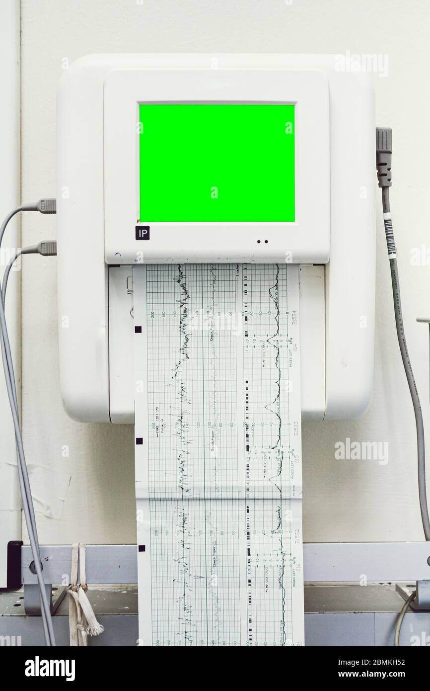 Contraction monitor hi-res stock photography and images - Alamy