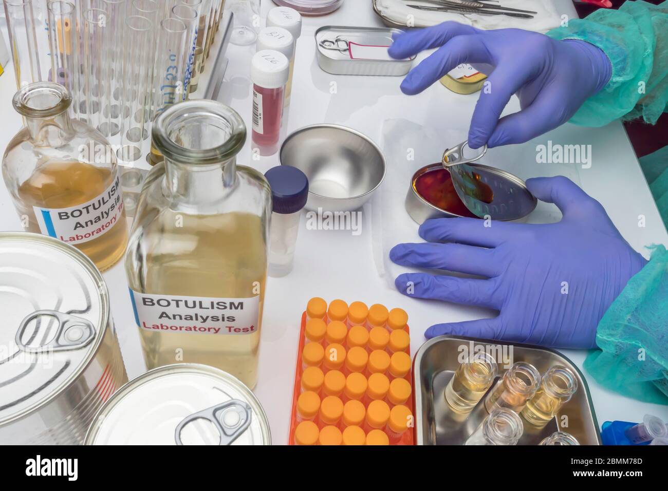 Specialist scientist opens infected canned food, botulism infection in ...