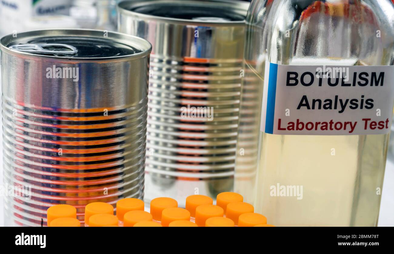 Several samples of tin cans, botulism infection in sick people ...