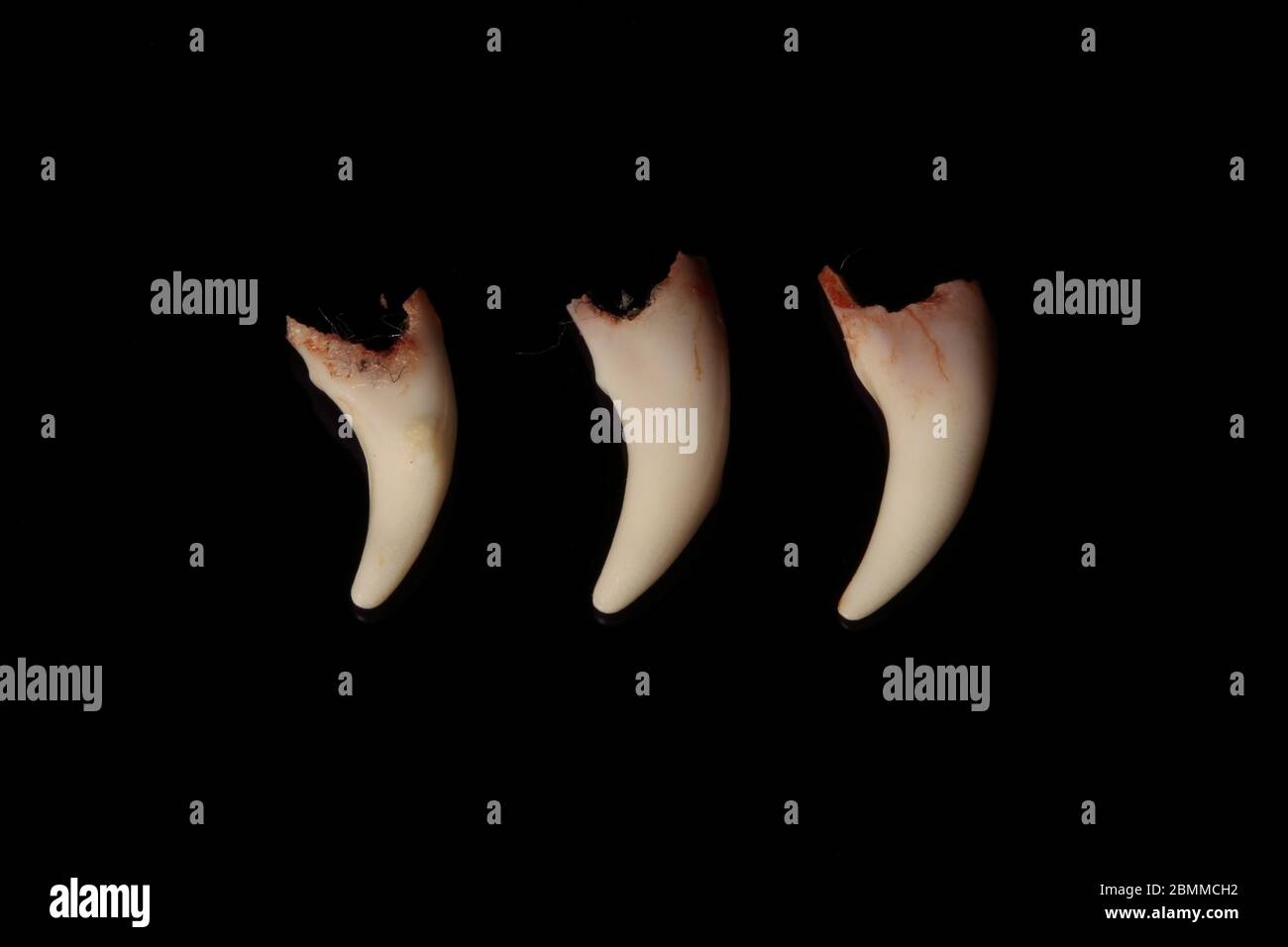 Lost teeth hi-res stock photography and images - Alamy