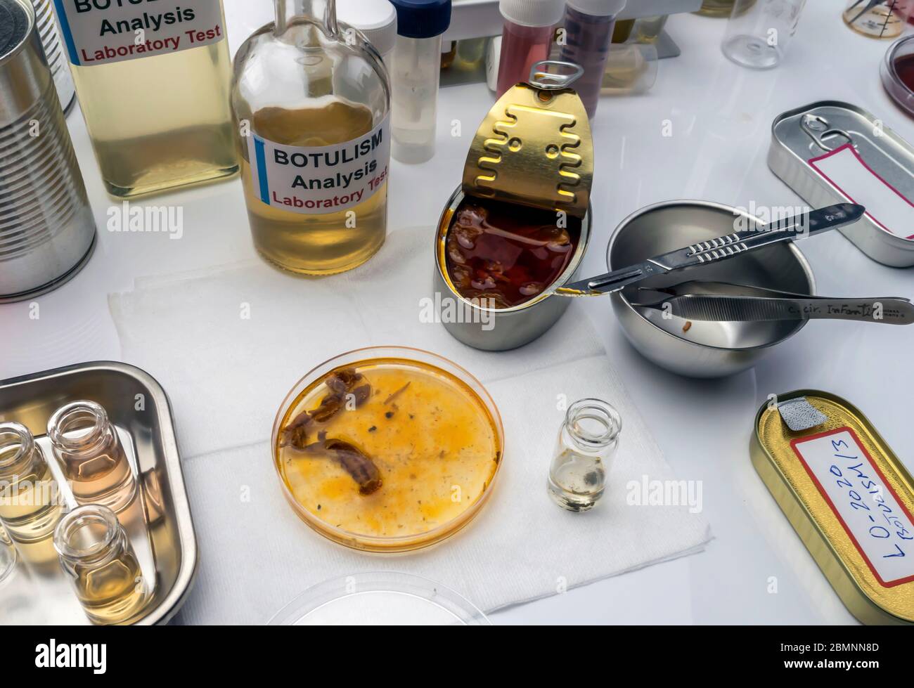 Several samples of tin cans, botulism infection in sick people ...