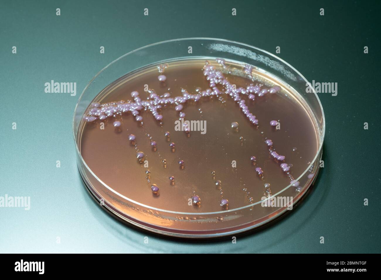 Pseudomonas Aeruginosa On Macconkey Agar