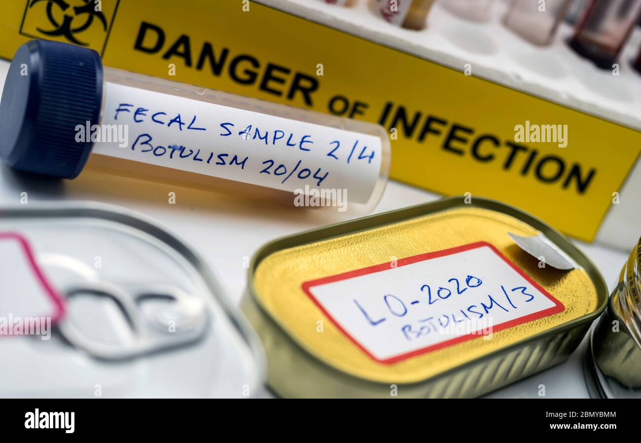 Fecal sample of a person infected with botulism, infection in tin cans ...