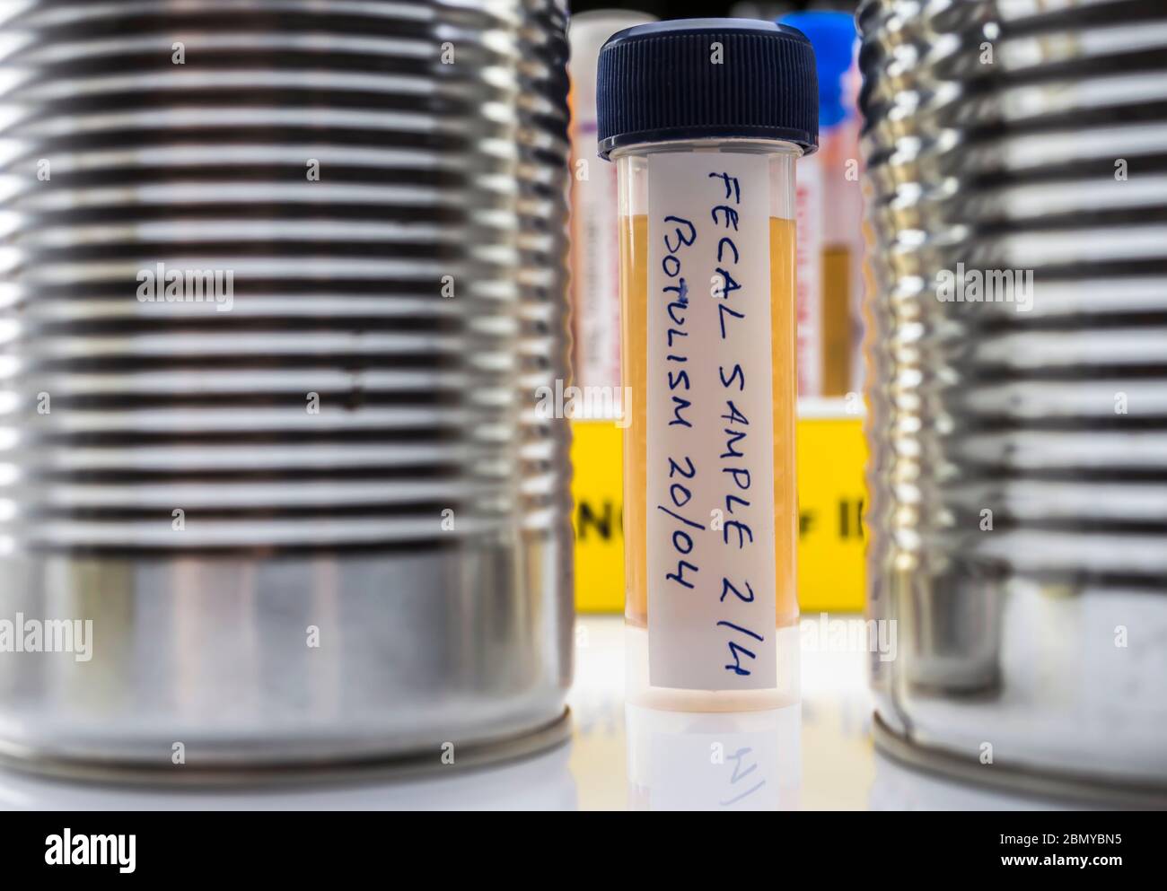 Fecal sample of a person infected with botulism, infection in tin cans ...