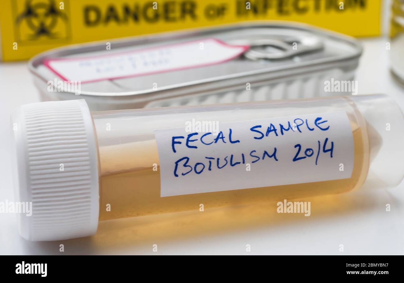 Fecal sample of a person infected with botulism, infection in tin cans ...