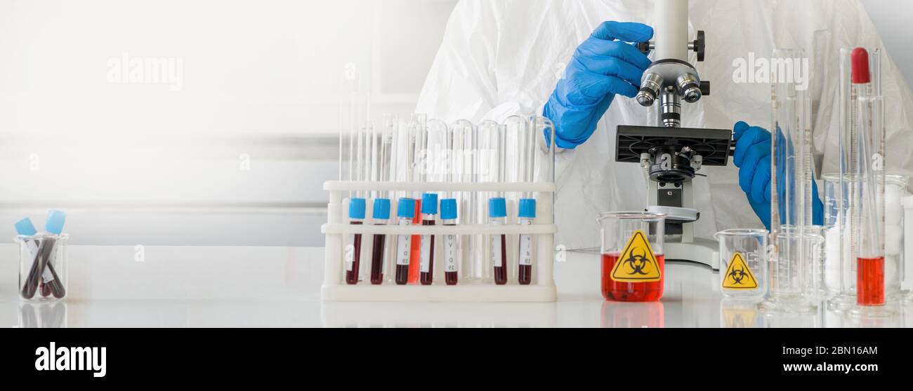 Researchers use microscopes to look at blood samples of infected people ...