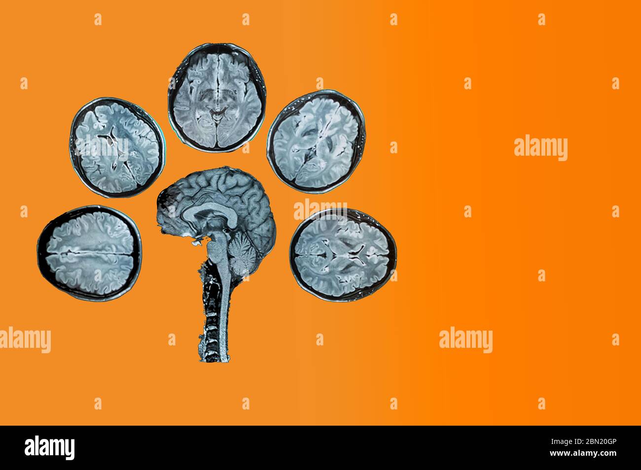 Mri medical image hi-res stock photography and images - Alamy