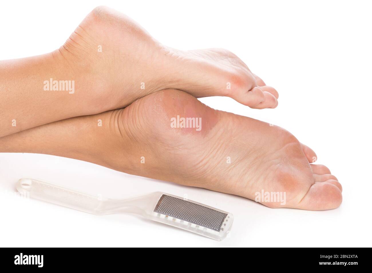 Female feet and callus remover tool on white background Stock Photo - Alamy