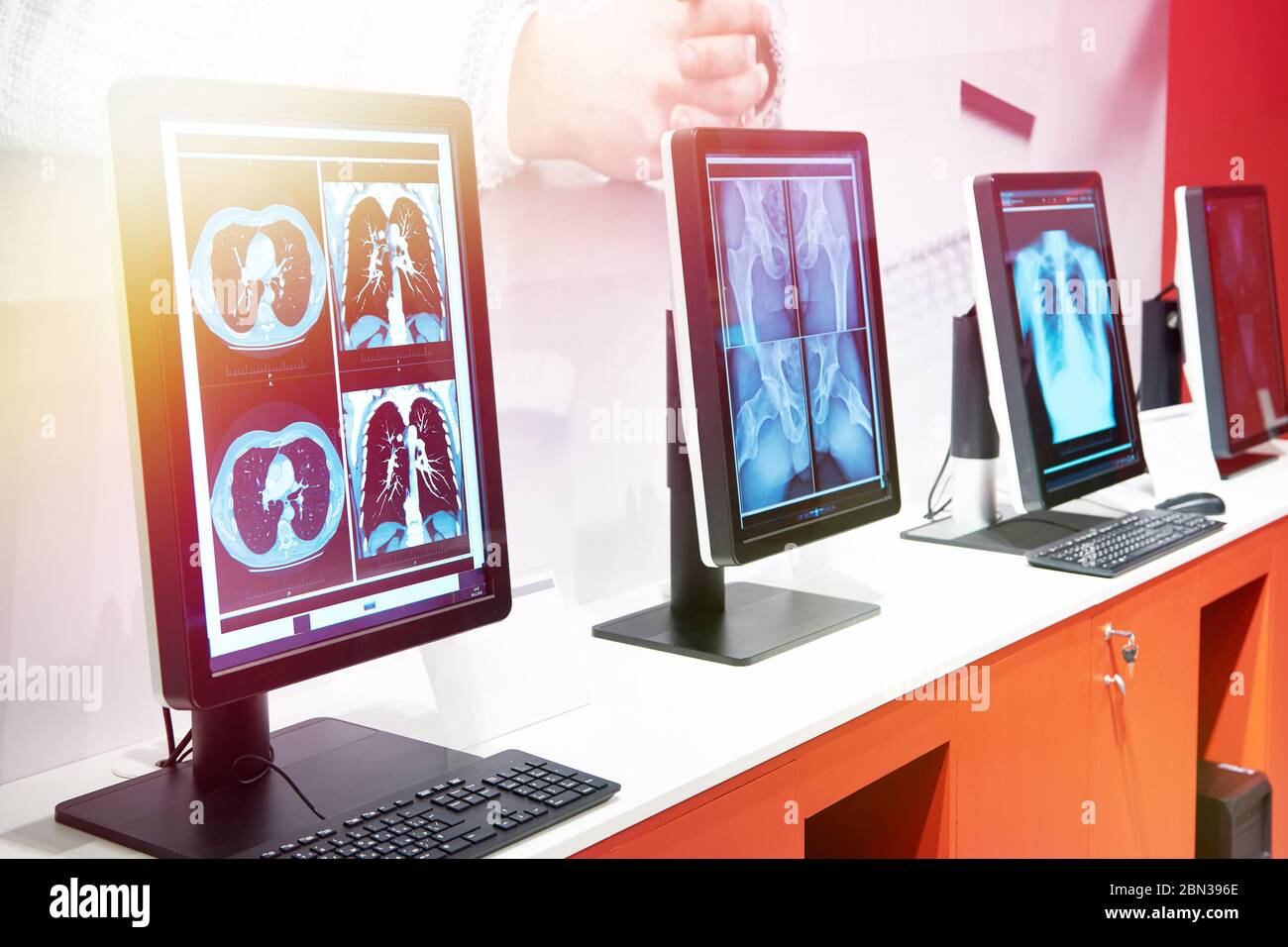 Hospital monitor xray hi-res stock photography and images - Alamy