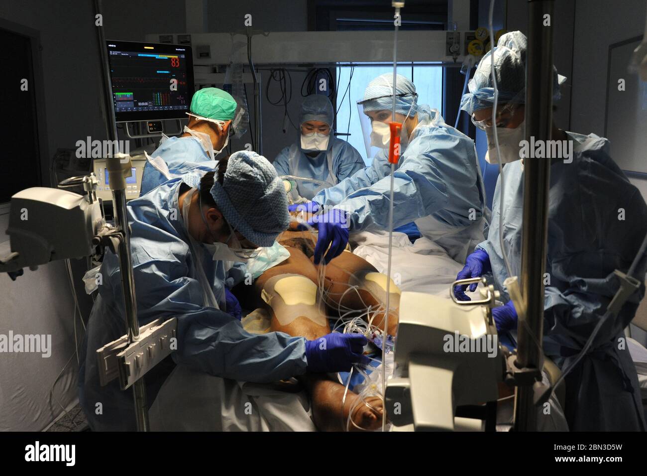 Resuscitation team hi-res stock photography and images - Alamy
