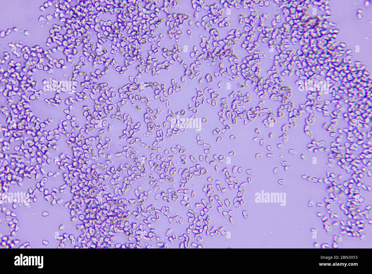 erythrocyte blood cells under the microscope Stock Photo - Alamy