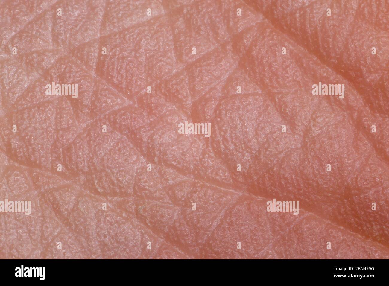 Texture of human foot skin. Dried skin spores. Extreme close up macro ...