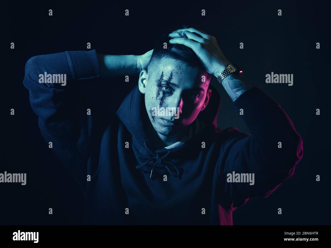 Teenage boy with wounds on face. Bullying and harassment Stock Photo ...