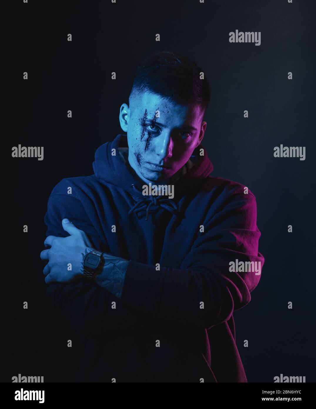 Teenage boy with wounds on face. Bullying and harassment Stock Photo ...