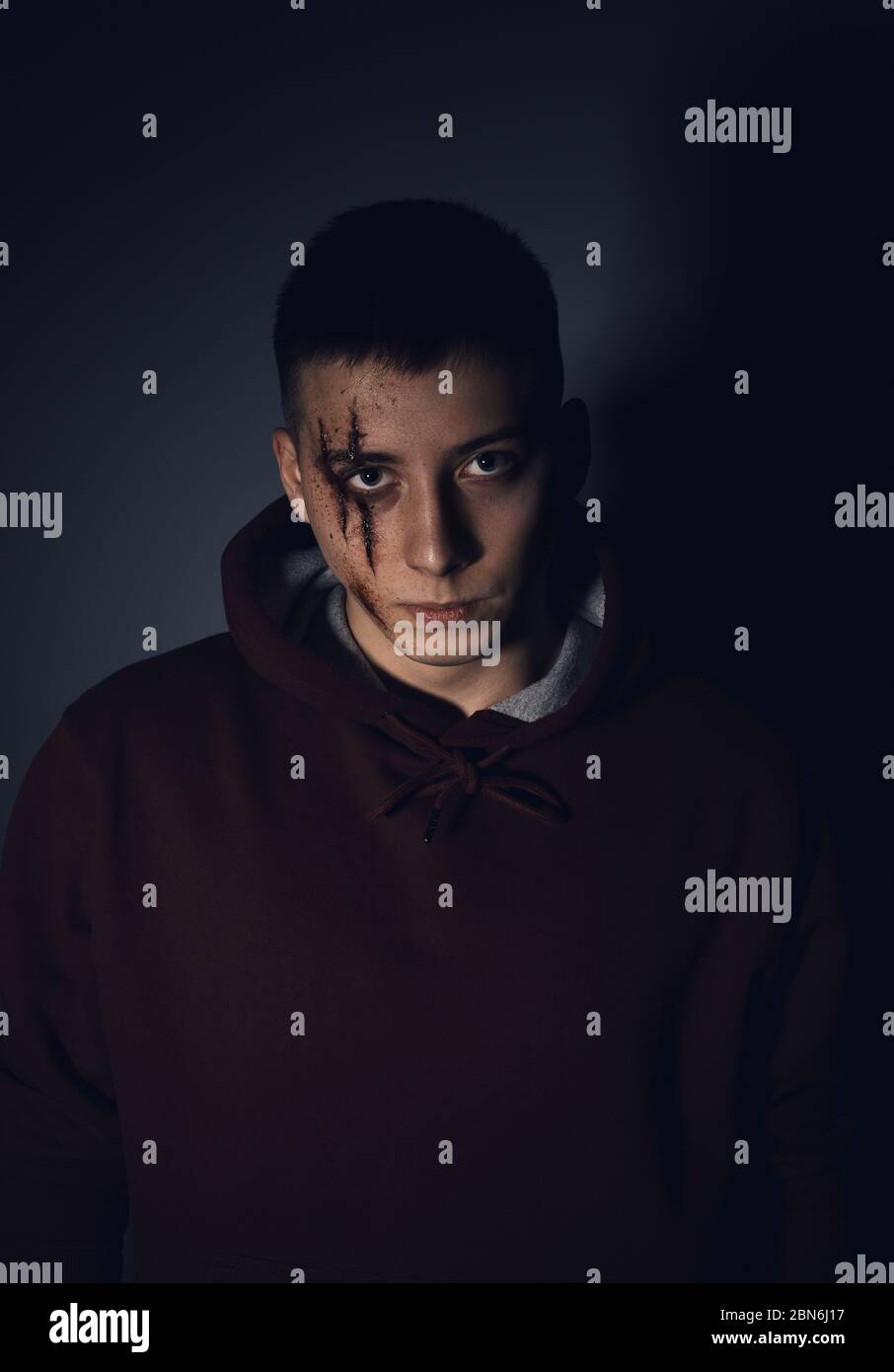 Teenage boy with wounds on face. Bullying and harassment Stock Photo ...