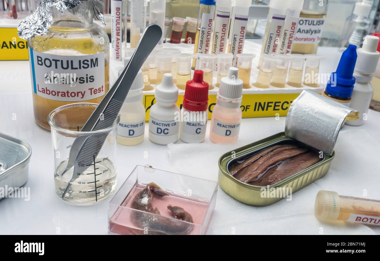 Canned food can contaminated by Clostridium botulinum toxin that causes ...