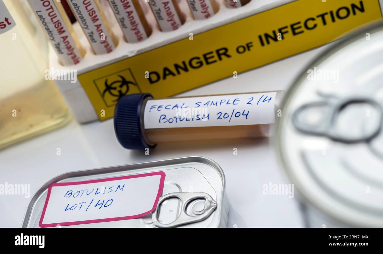 Fecal sample of a person infected with botulism, infection in tin cans ...
