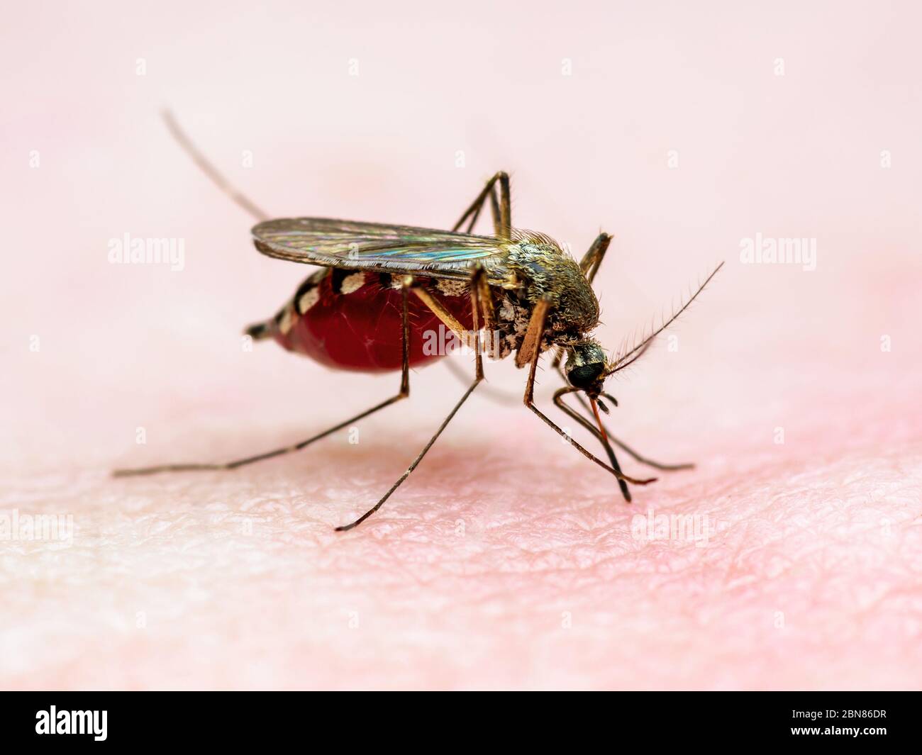 Encephalitis, Yellow Fever, Malaria Disease, Mayaro or Zika Virus ...