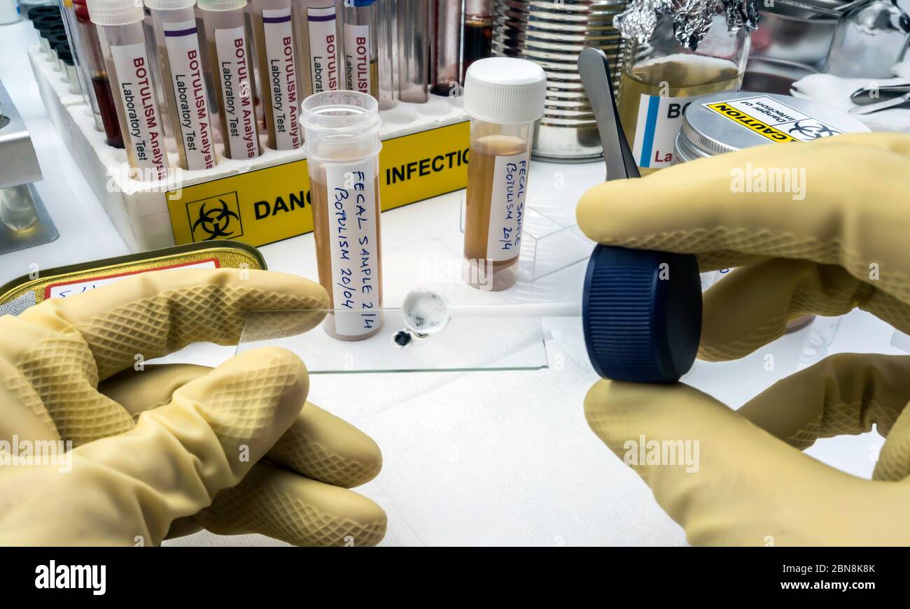 Botulism diagnosis hi-res stock photography and images - Alamy