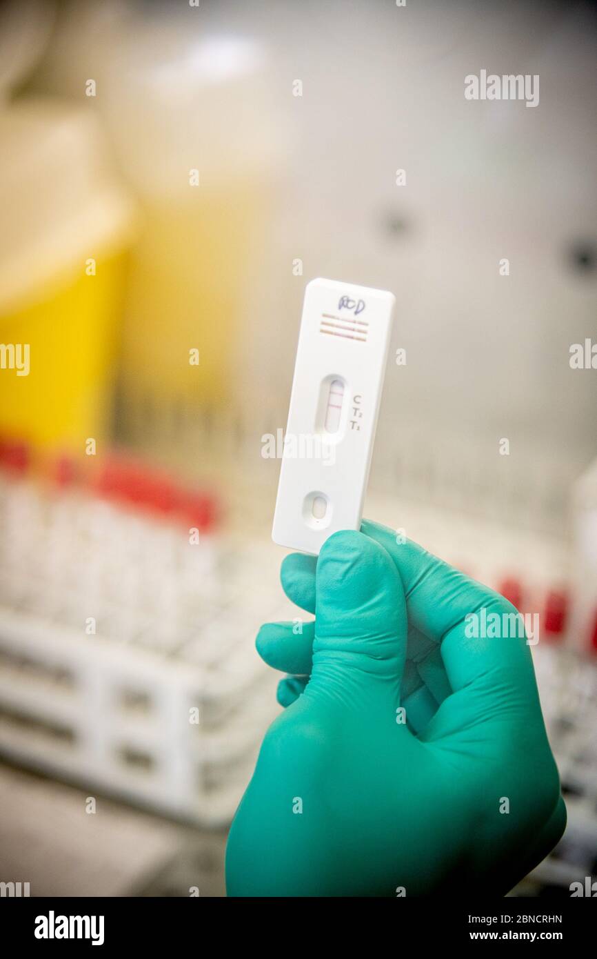 COVID-19 serological tests for individuals, microbiology and virology ...