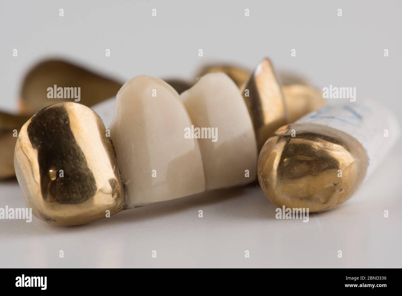 stamped brazed dental bridges covered with gold coated on white ...