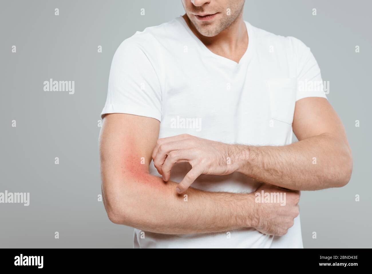 Scratching itchy skin sensitive hi-res stock photography and images - Alamy