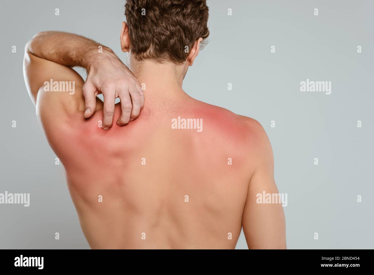 Back view of man scratching skin with allergy isolated on grey Stock ...
