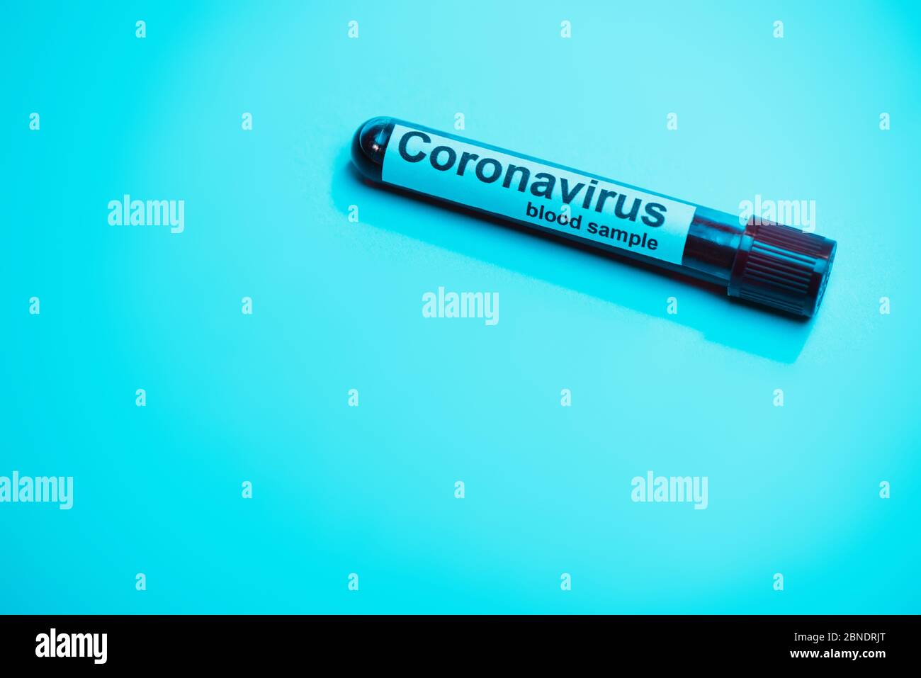 High angle view of test tube with coronavirus blood sample on blue ...