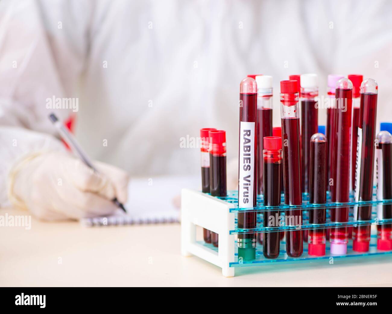 The young handsome lab assistant testing blood samples in hospital ...