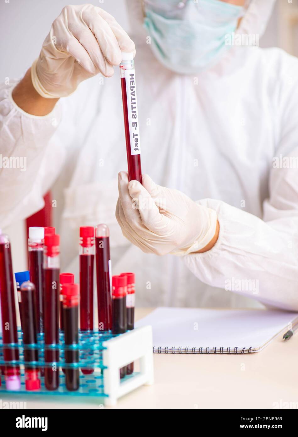 The young handsome lab assistant testing blood samples in hospital ...