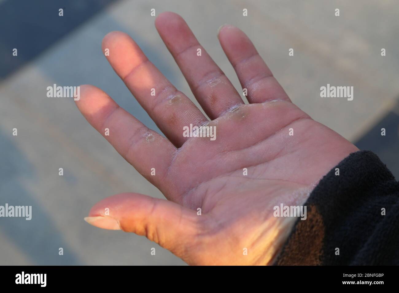 Huang Zhongyu shows his hands at Chang'an Park, Shijiazhuang city ...